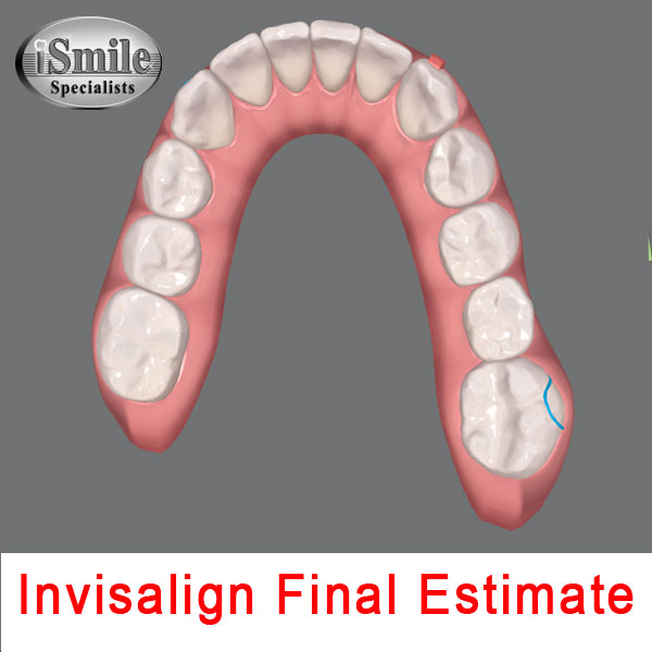 Top Invisalign Providers in Houston and Sugar Land, Texas