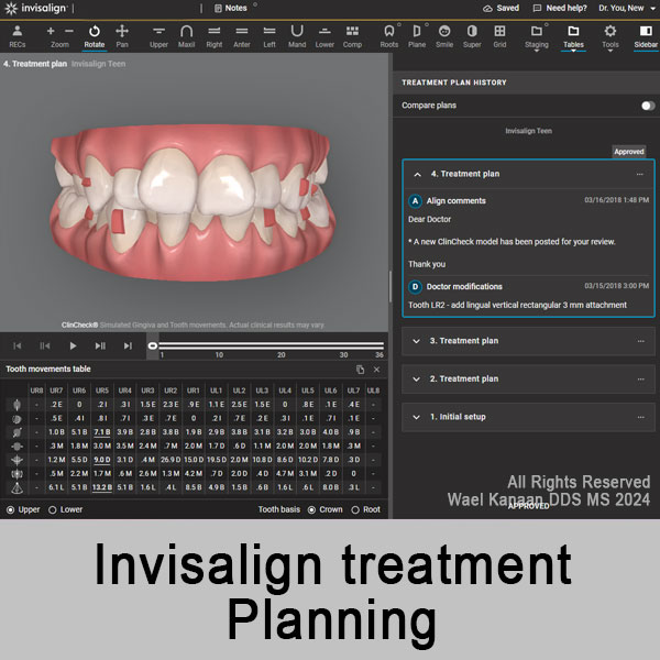 Top Invisalign Providers in Houston and Sugar Land, Texas